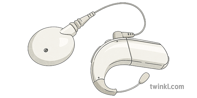 Cochlear Implant Illustration - Twinkl