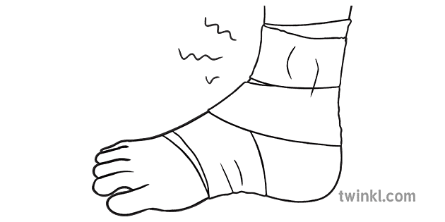 Ankle Ligament Sprain Anterior Talofibular Cuboid Foot Sprained Pain ...