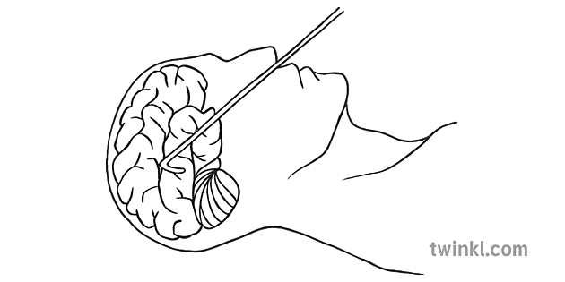 Hook Into Brain Preparation Ancient Egyptian Mummification Rapid Response