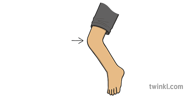 Childs Knee Illustration - Twinkl