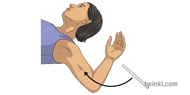 Contraceptive Implant in Arm Ver 1 - Twinkl