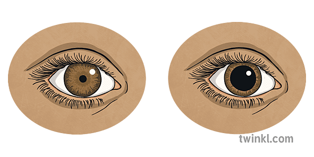 Two Eyes Different Size Pupils Illustration - Twinkl