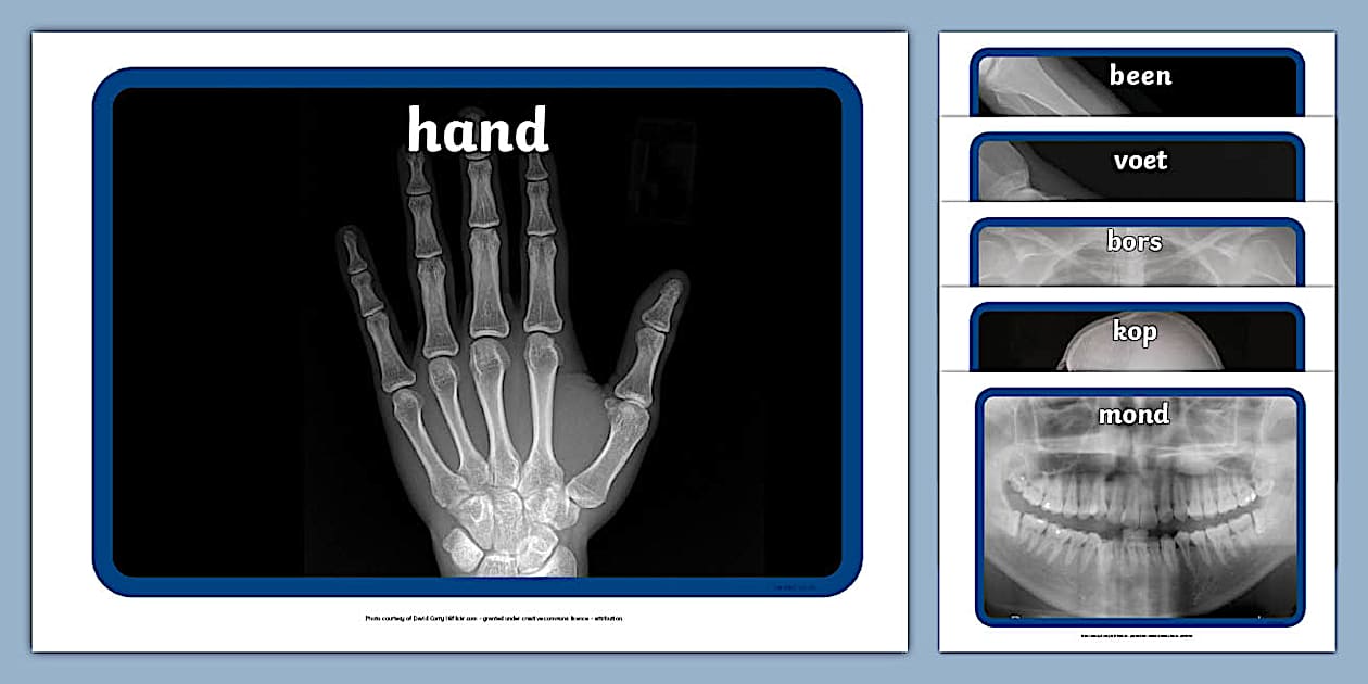 X-Strale Vertoon Fotos (professor feito) - Twinkl