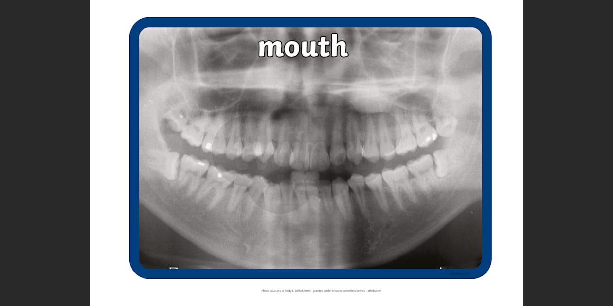 how x rays work gcse