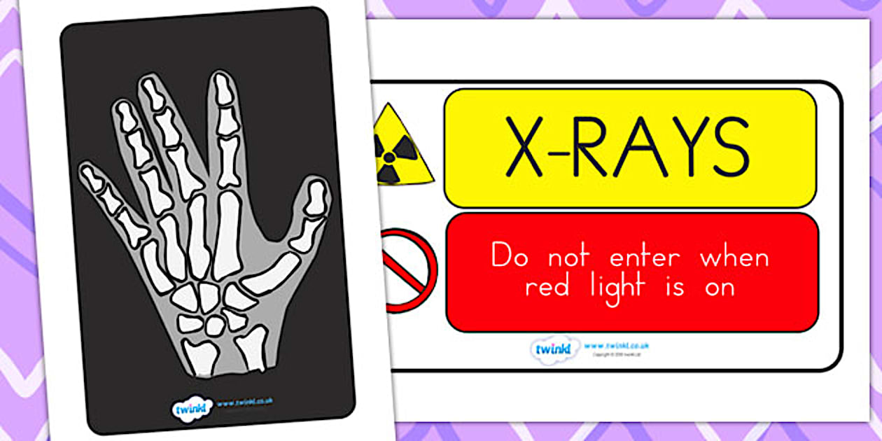 X Ray Display Signs (ティーチャーメイド) - Twinkl