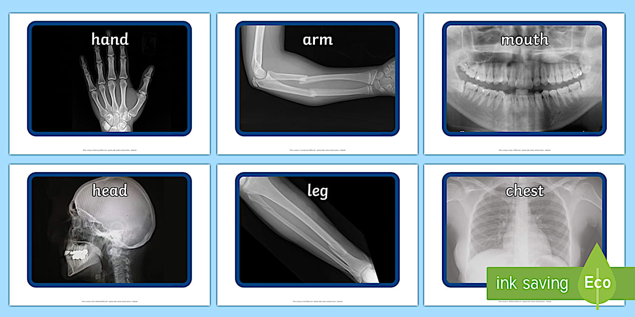 Editable X-Ray Display Photos (teacher made) - Twinkl