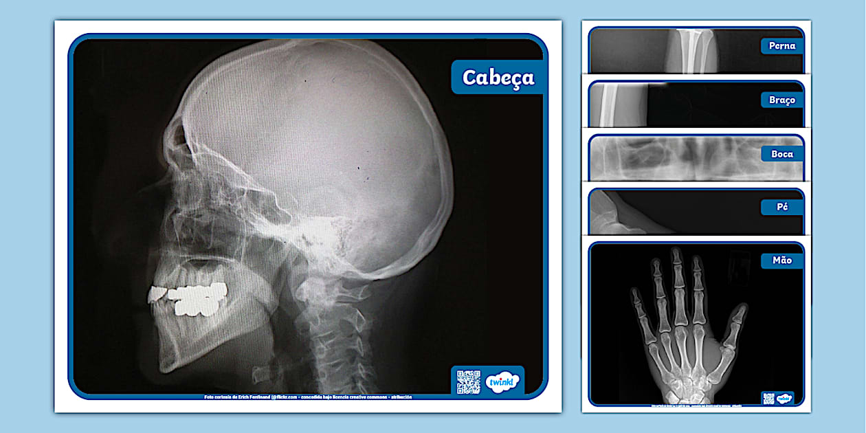 Pôsteres - Radiografias do corpo humano - Twinkl