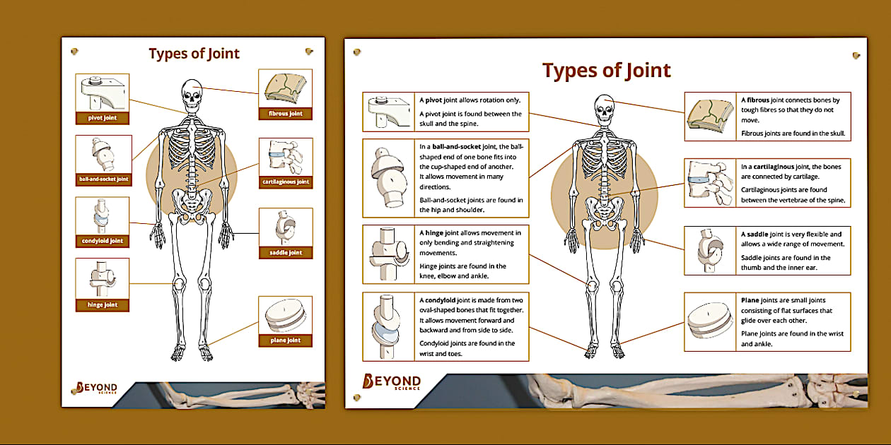 Types of Joint Poster (teacher made) - Twinkl