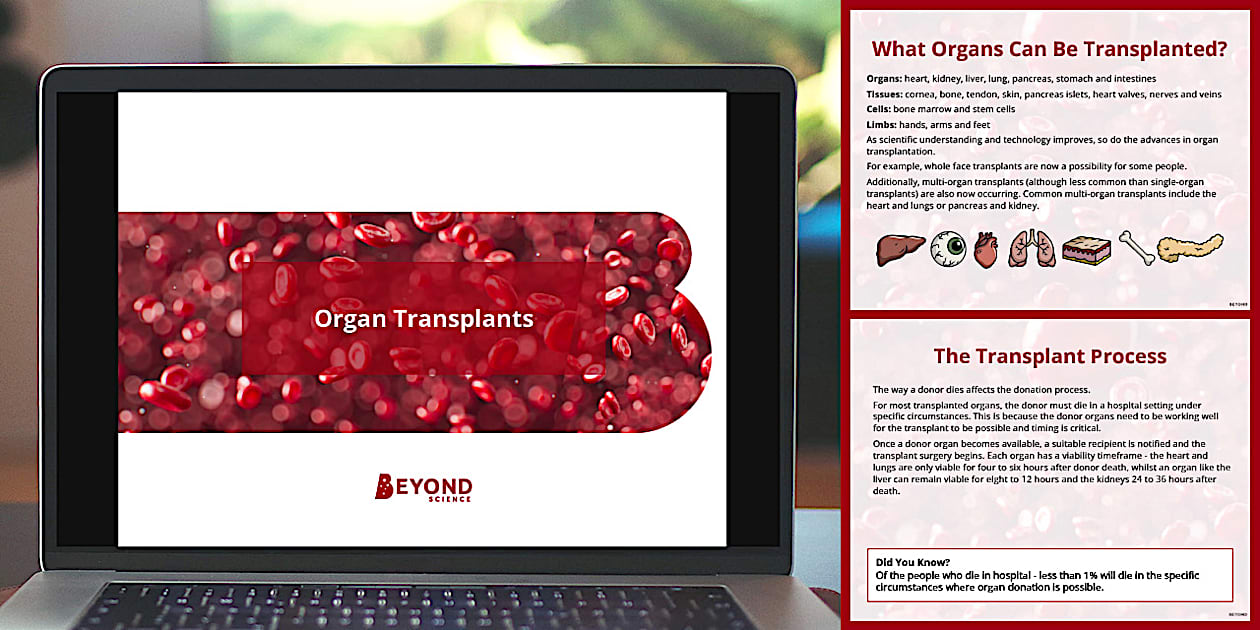 Organ Transplant PowerPoint - Beyond Secondary - Science