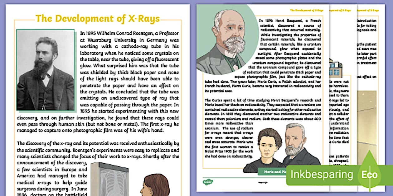 The Development of X-rays Comprehension (teacher made)