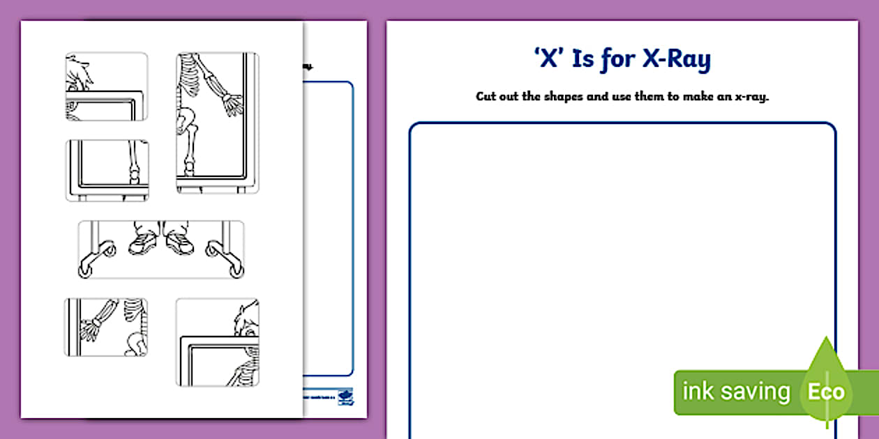 'X' Is for X-Ray Craft (teacher made) - Twinkl