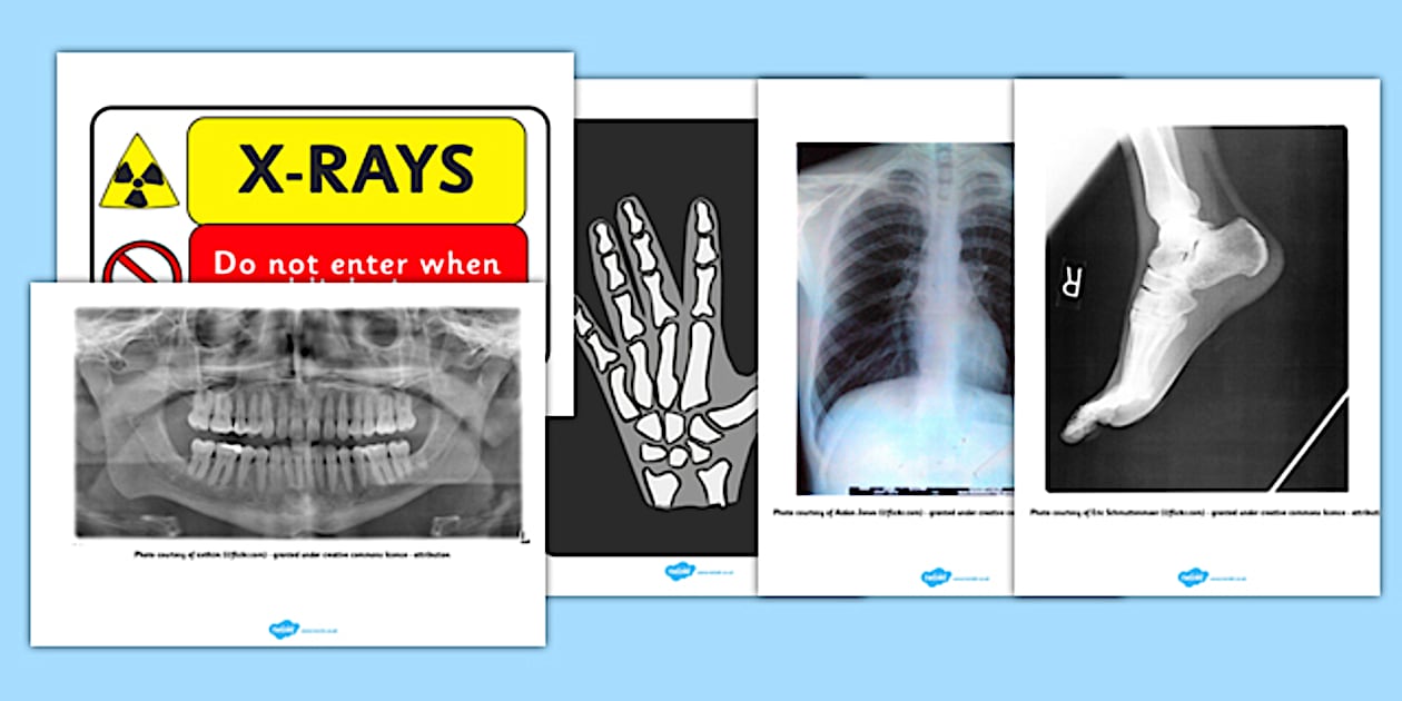 X-Ray Display Signs (Teacher-Made) - Twinkl