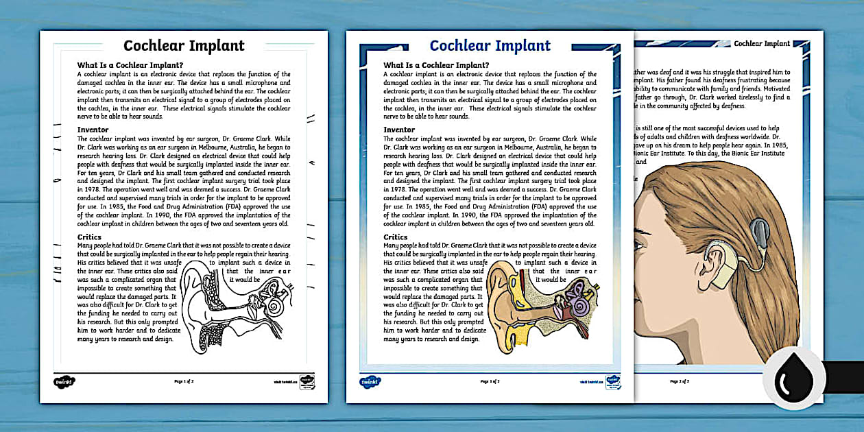 Invention of the Cochlear Implant Reading Comprehension