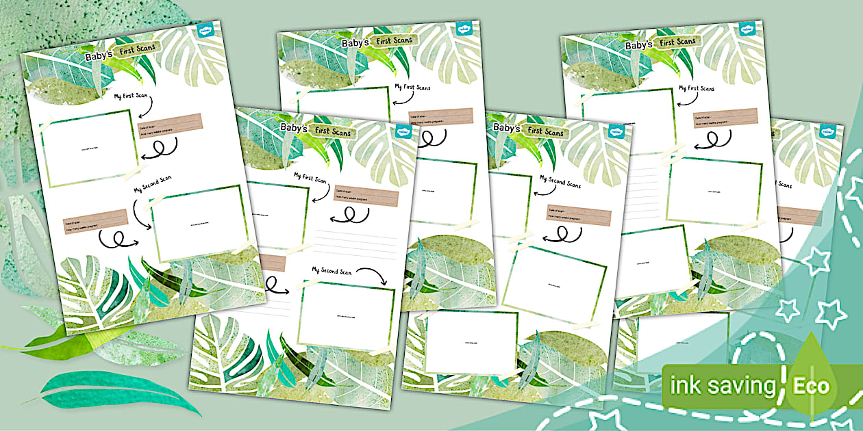 Baby's First Scans - My Baby Journal (teacher made) - Twinkl