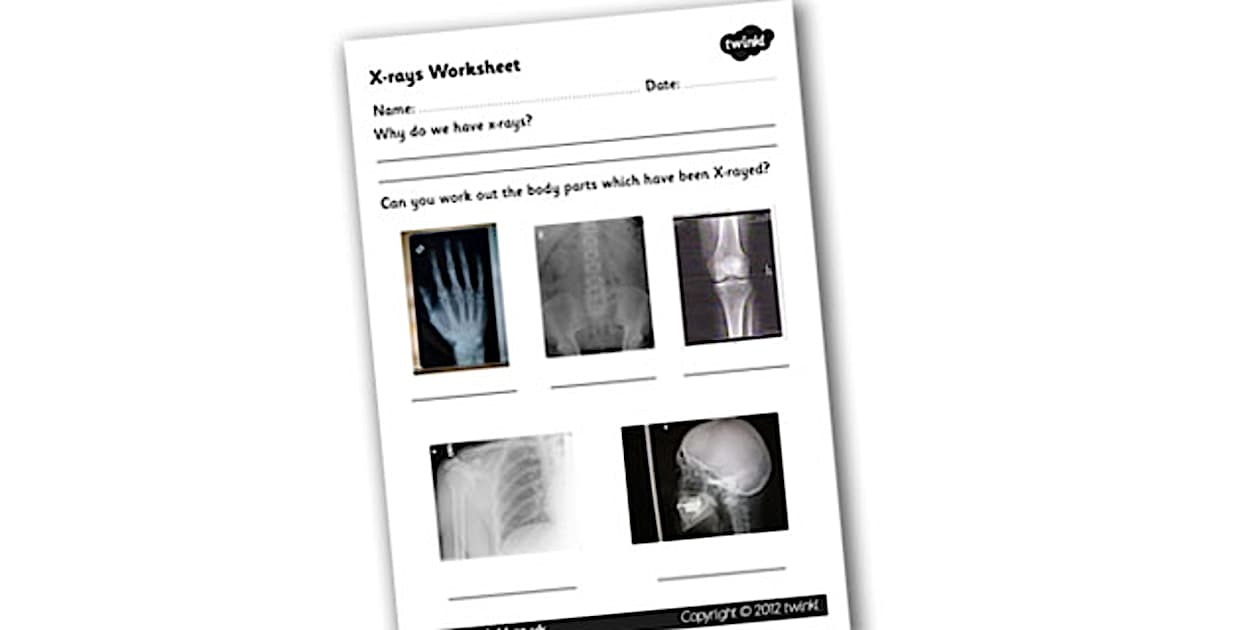 X-Ray Worksheet (teacher made) - Twinkl