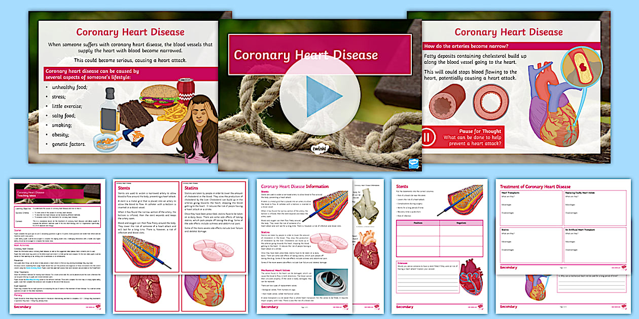 AQA Biology Unit 2: Coronary Heart Disease Lesson Pack