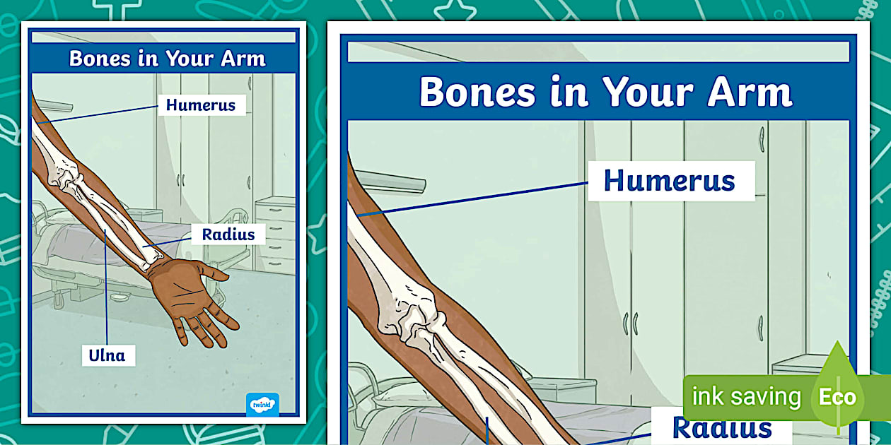 Bones in the Arm Display Poster (teacher made) - Twinkl