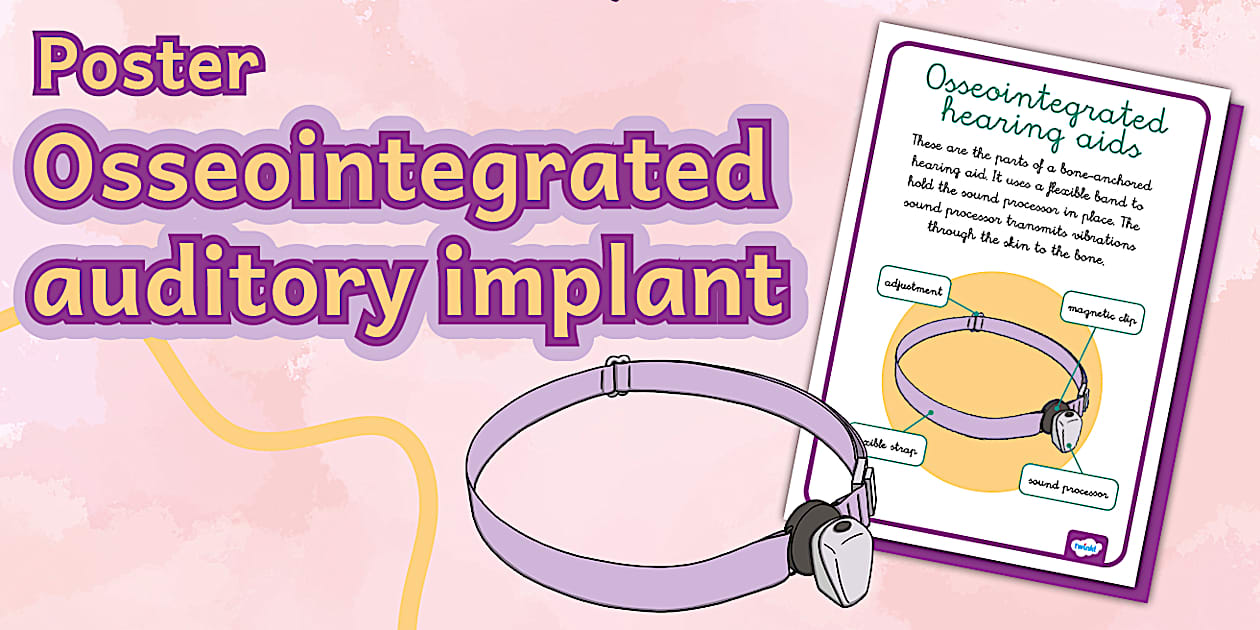 Poster: Osseointegrated auditory implant