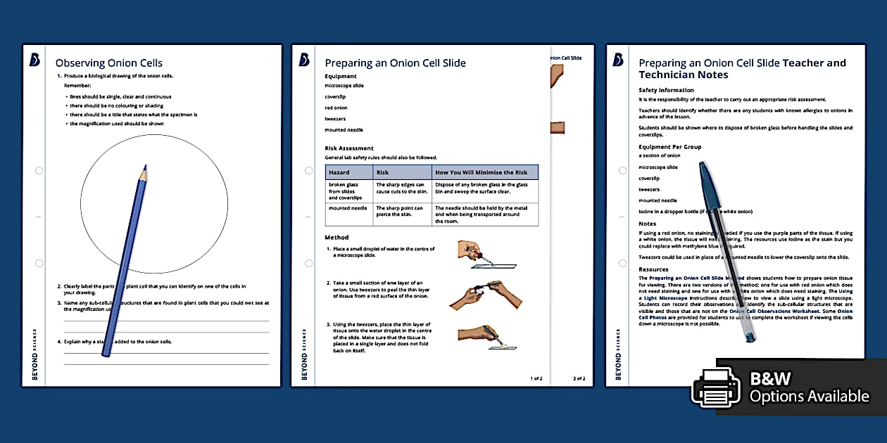 Preparing Onion Cell Microscope Slide Investigation | Beyond