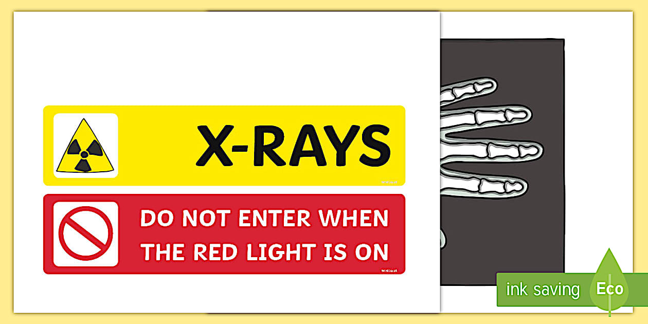 Toy Hospital X Ray Display Signs (teacher made) - Twinkl