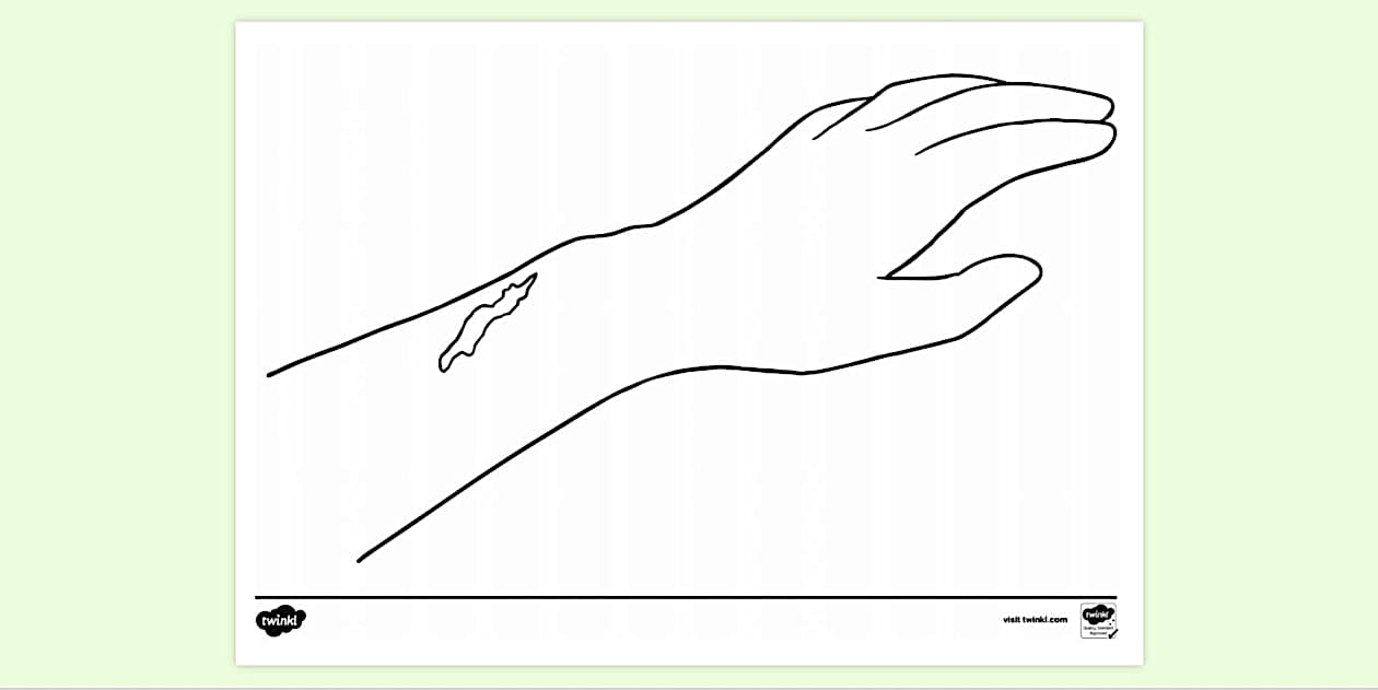 Wound on Arm Colouring Sheet | Colouring Sheets - Twinkl