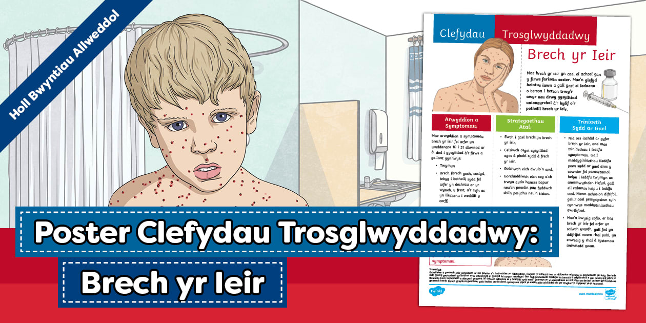 Poster Clefydau Trosglwyddadwy: Brech yr Ieir