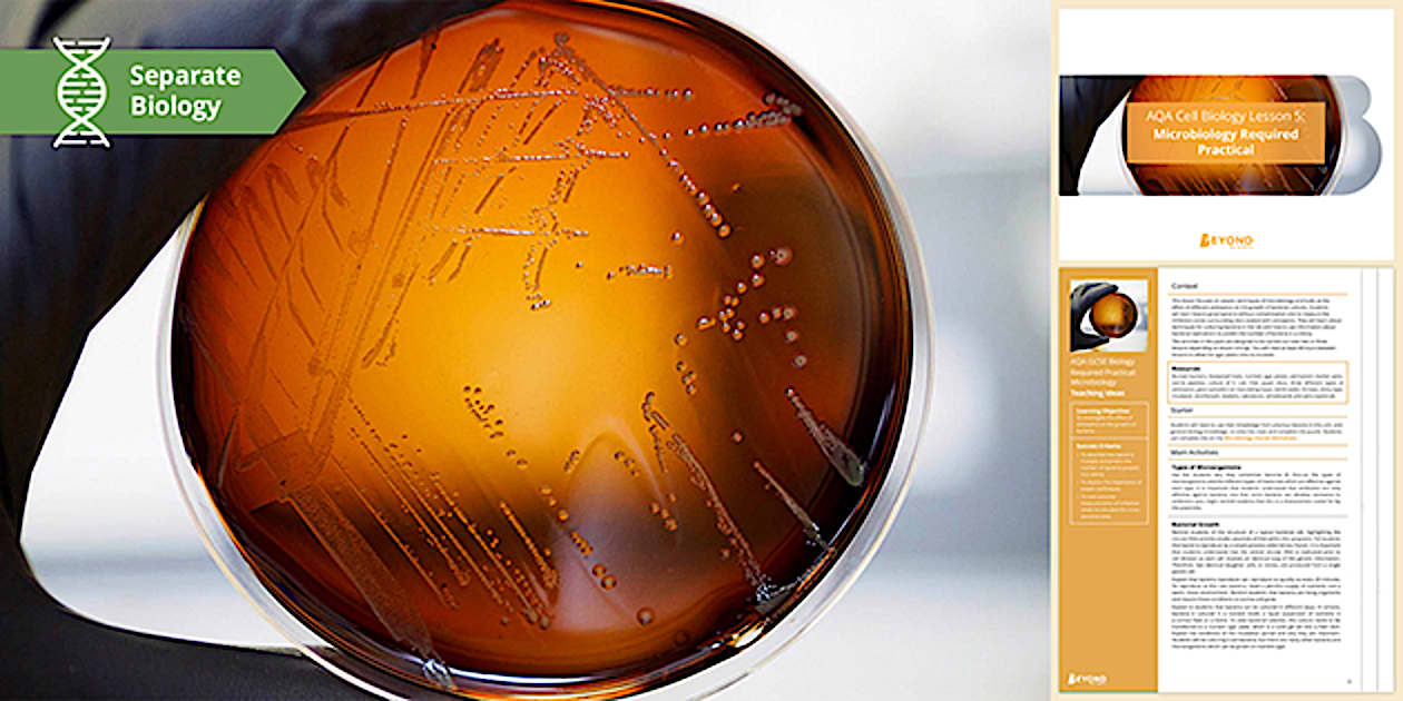 AQA GCSE Microbiology Required Practical (Biology Only) | Beyond