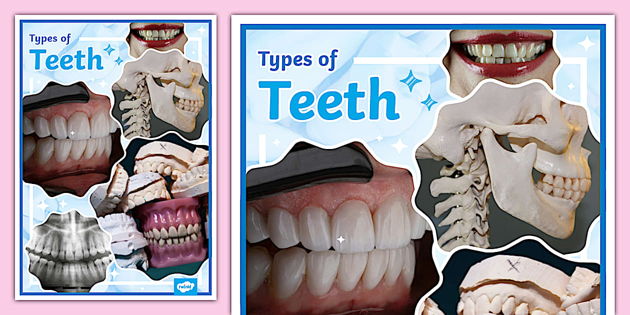 Types of Teeth Photo Display Poster (teacher made) - Twinkl