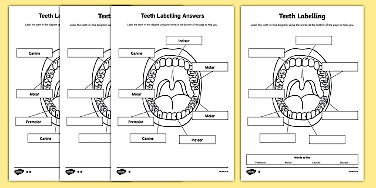 Editable Teeth Labelling Worksheet (teacher made) - Twinkl