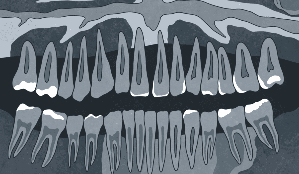 Drug Designed to Help Regrow Teeth Being Trialled - Twinkl NewsRoom