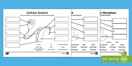 What is a Cochlear Implant? - Answered - Twinkl Teaching Wiki
