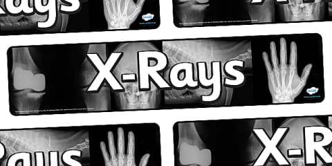 Toy Hospital X-Ray Display Signs