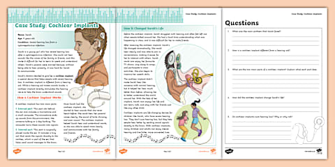 How Does Hearing with a Cochlear Implant Work? Poster