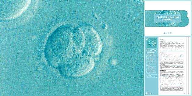 AQA GCSE Cell Biology Lesson 7: Stem Cells | Beyond