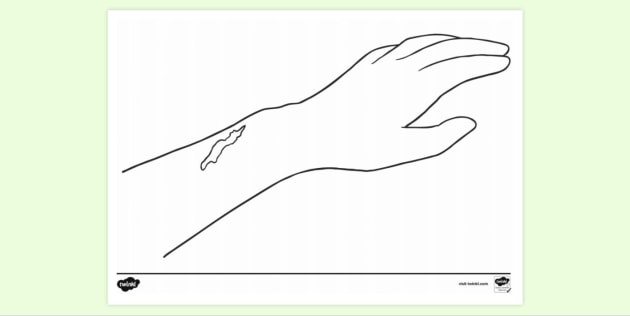 Wound on Arm Colouring Sheet | Colouring Sheets