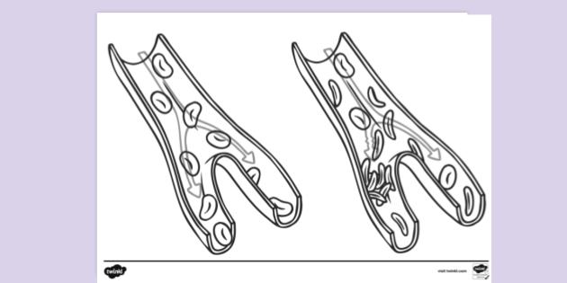 FREE! - Sickle Cell Blood Vessels Colouring | Colouring Sheets