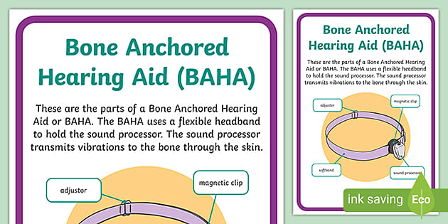 BAHA Hearing Aid Display Poster (teacher made) - Twinkl